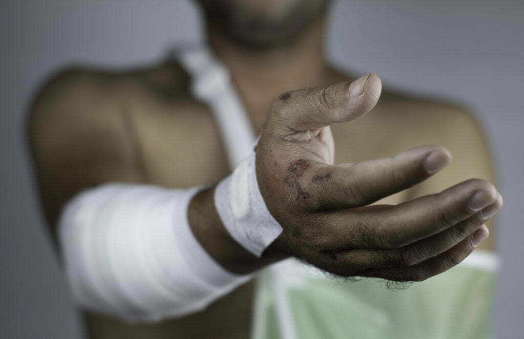 Managing Phantom Limb Pain: How To Manage It Correctly?