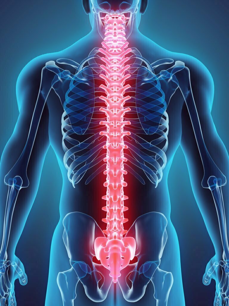 How To Get The Best Results From Epidural Injections - Illinois Pain ...