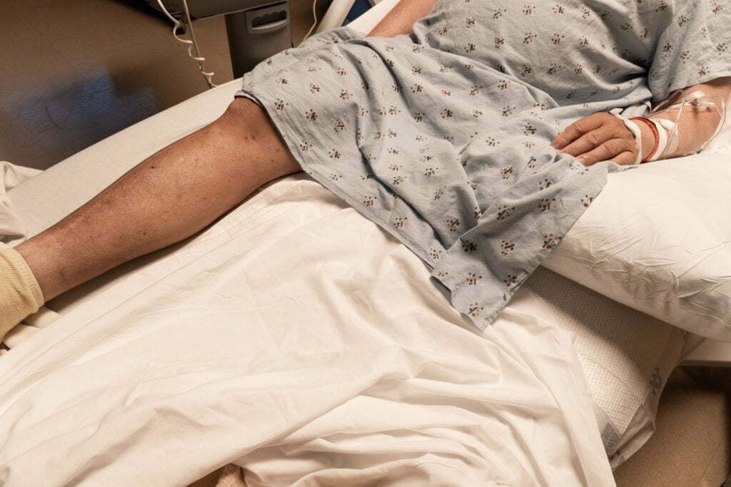 Five Possible Treatment Options for Phantom Limb Pain