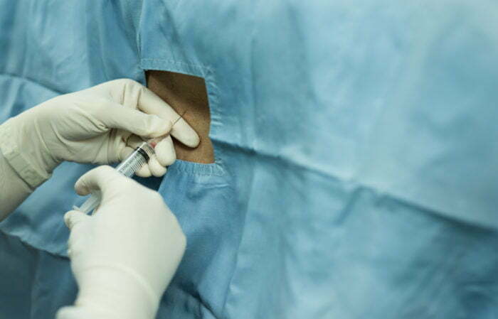 Epidural Injections for Pain Management - Illinois Pain & Spine Institute