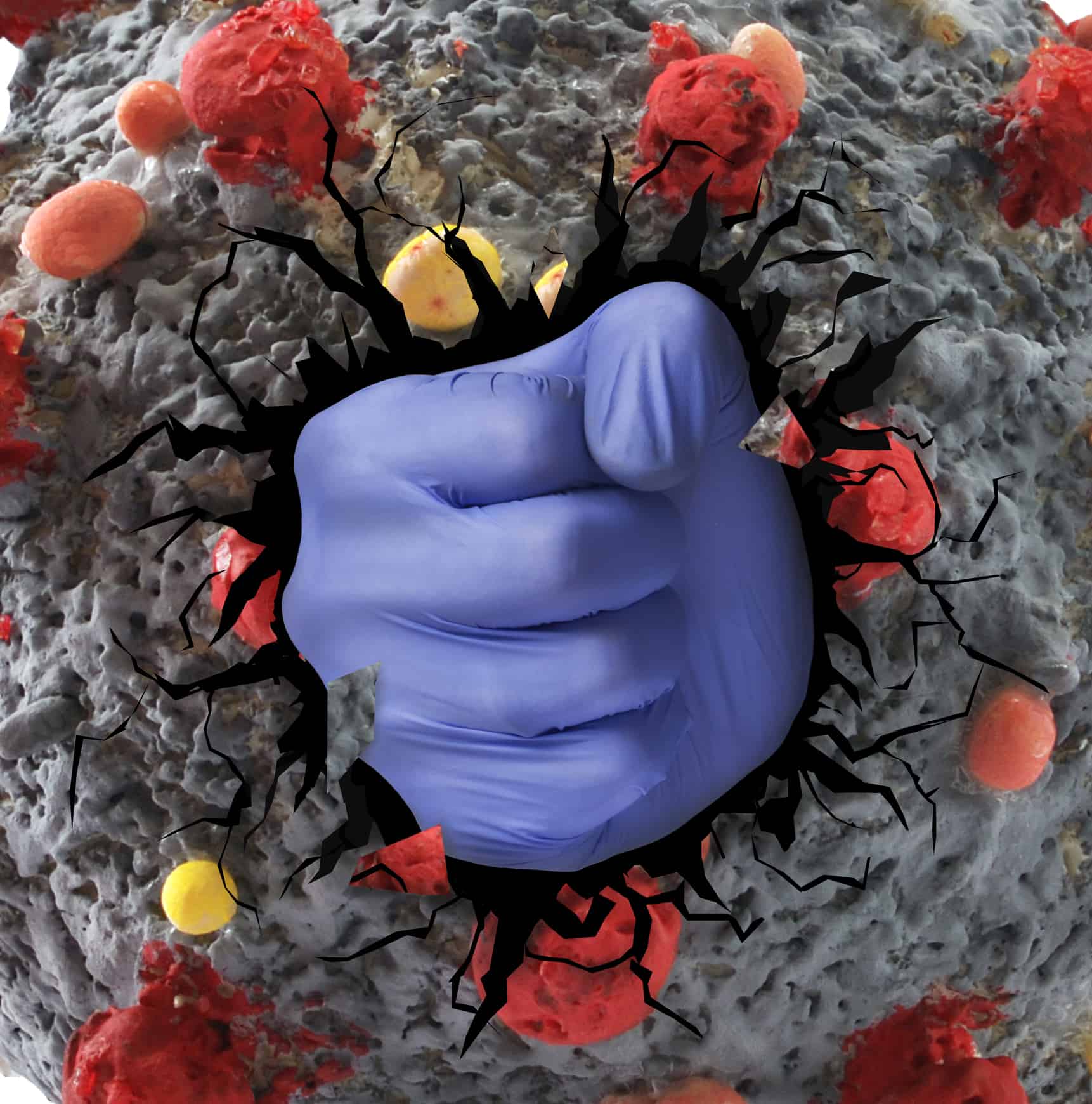 What Makes Cancer Painful | Causes Of Cancer Pain