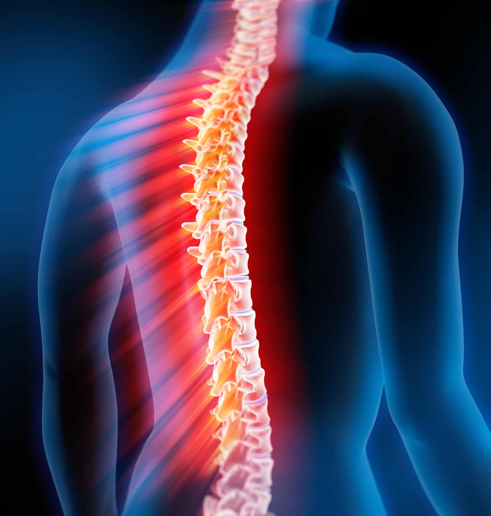Back Pain Specialist: What Is Percutaneous Discectomy